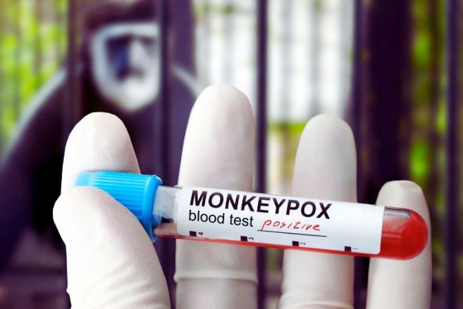Bengaluru Reports Karnataka's First Suspected Mpox Case; 40-YO Patient ...